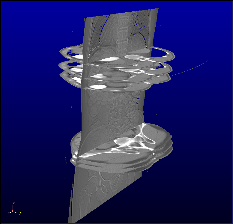 3d Slices